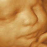 Multiple Marker Test - Medimujer